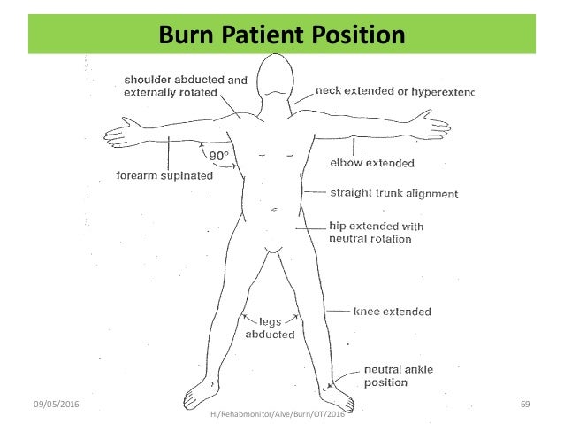 Physical Dysfunction: Burn Rehabilitation
