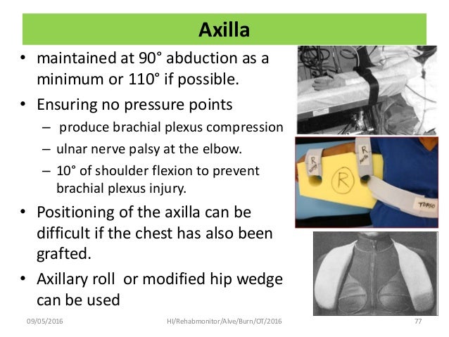 Physical Dysfunction: Burn Rehabilitation