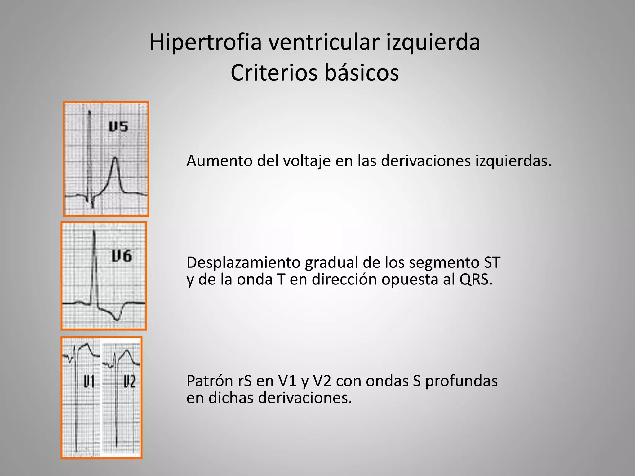 Lectura basica de ekg. | PPT