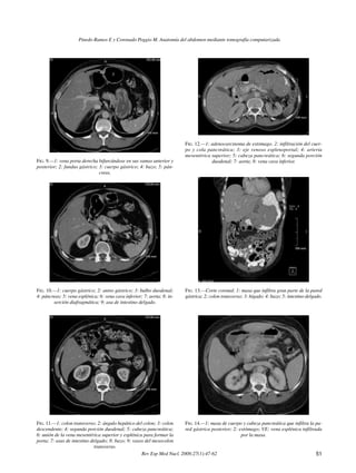 Lectura de anatomia tomografica del abdomen y pelvis | PDF