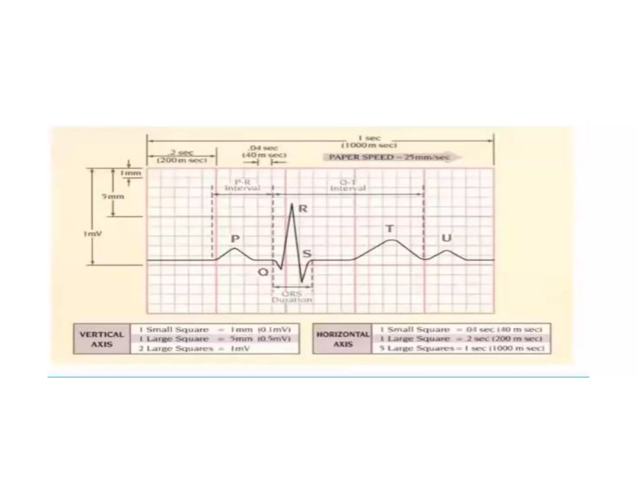 Lectura electrocardiograma | PPTX