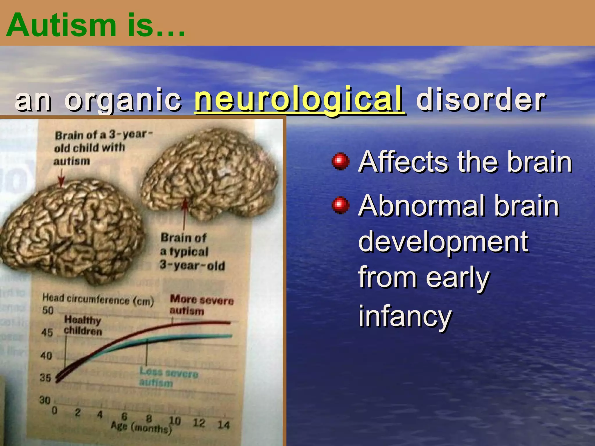 Autism Spectrum Disorder | PPT