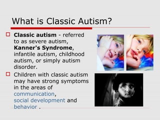 Autism Spectrum Disorder | PPT