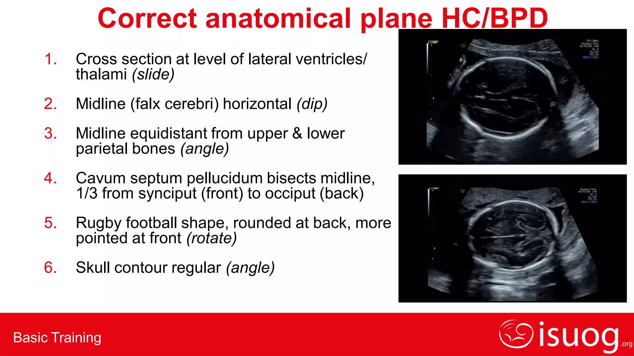 Lecture-10-Fetal-Biometry-Dating-Assessing-Size-Estimating-Fetal-Weight.pdf