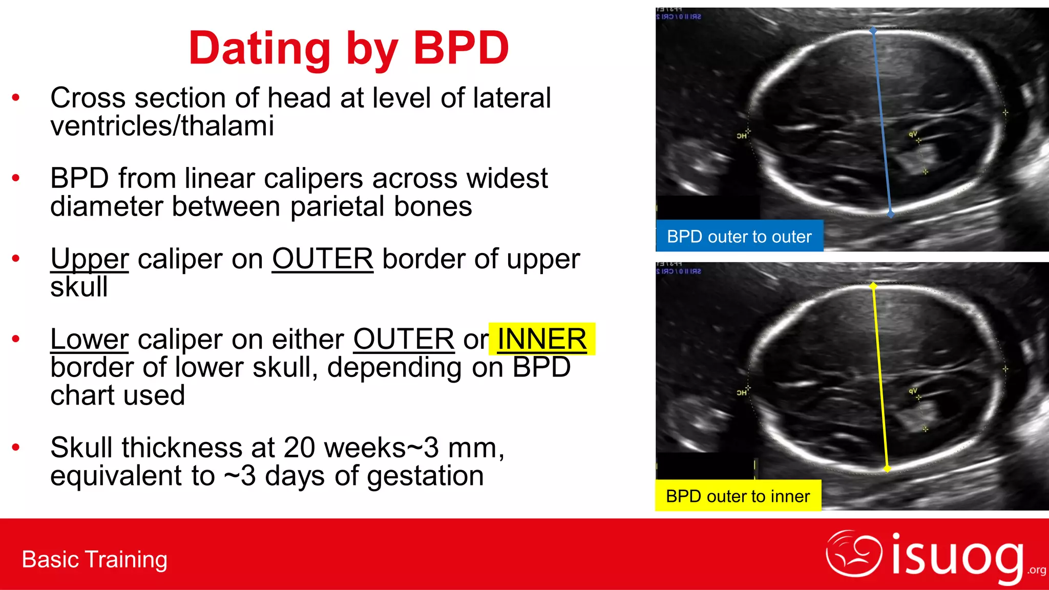 Lecture-10-Fetal-Biometry-Dating-Assessing-Size-Estimating-Fetal-Weight.pdf