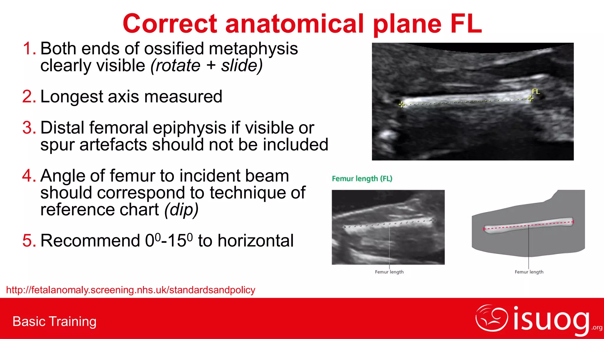 Lecture-10-Fetal-Biometry-Dating-Assessing-Size-Estimating-Fetal-Weight.pdf