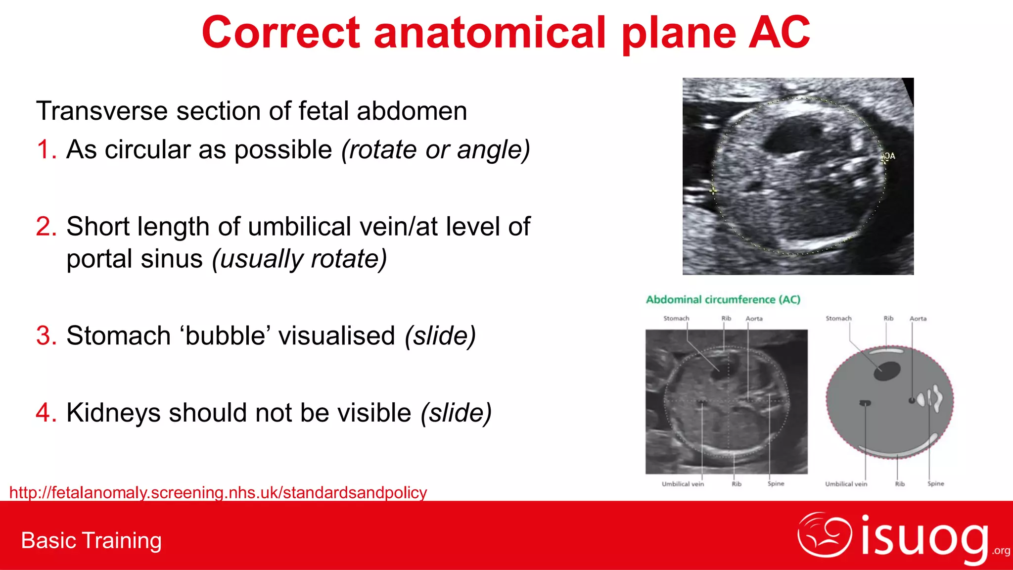 Lecture-10-Fetal-Biometry-Dating-Assessing-Size-Estimating-Fetal-Weight.pdf