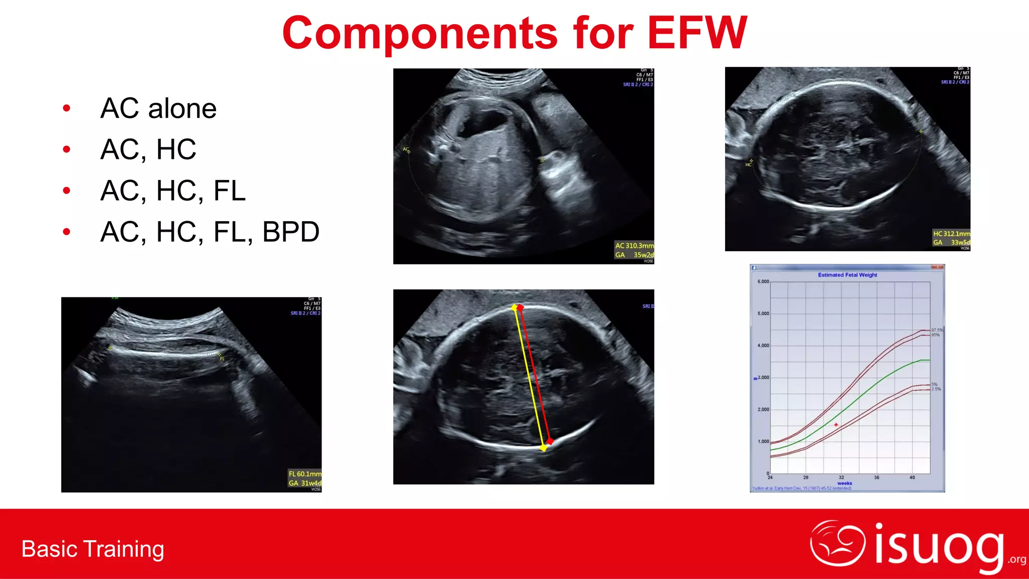Lecture-10-Fetal-Biometry-Dating-Assessing-Size-Estimating-Fetal-Weight.pdf