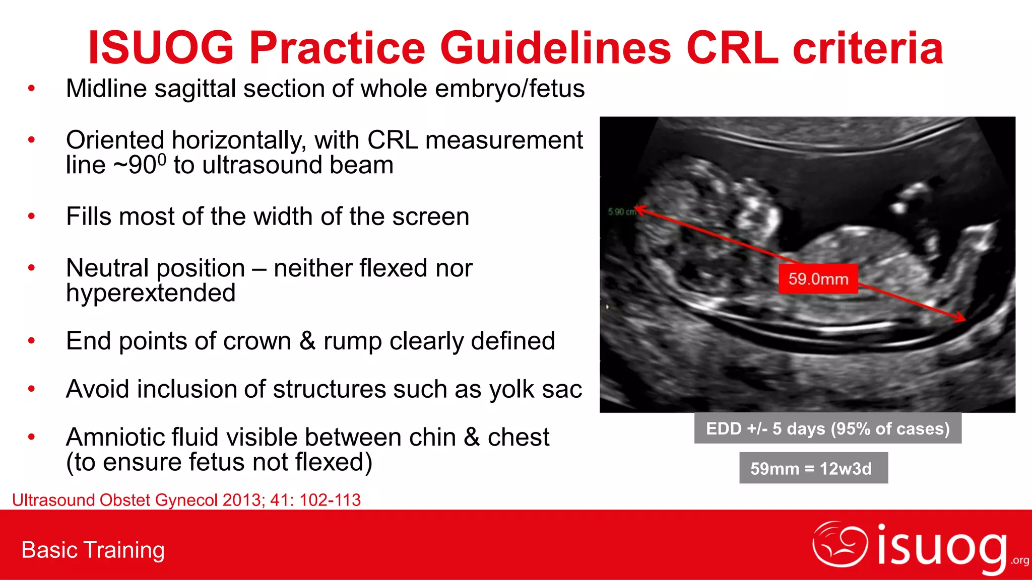 Lecture-10-Fetal-Biometry-Dating-Assessing-Size-Estimating-Fetal-Weight.pdf