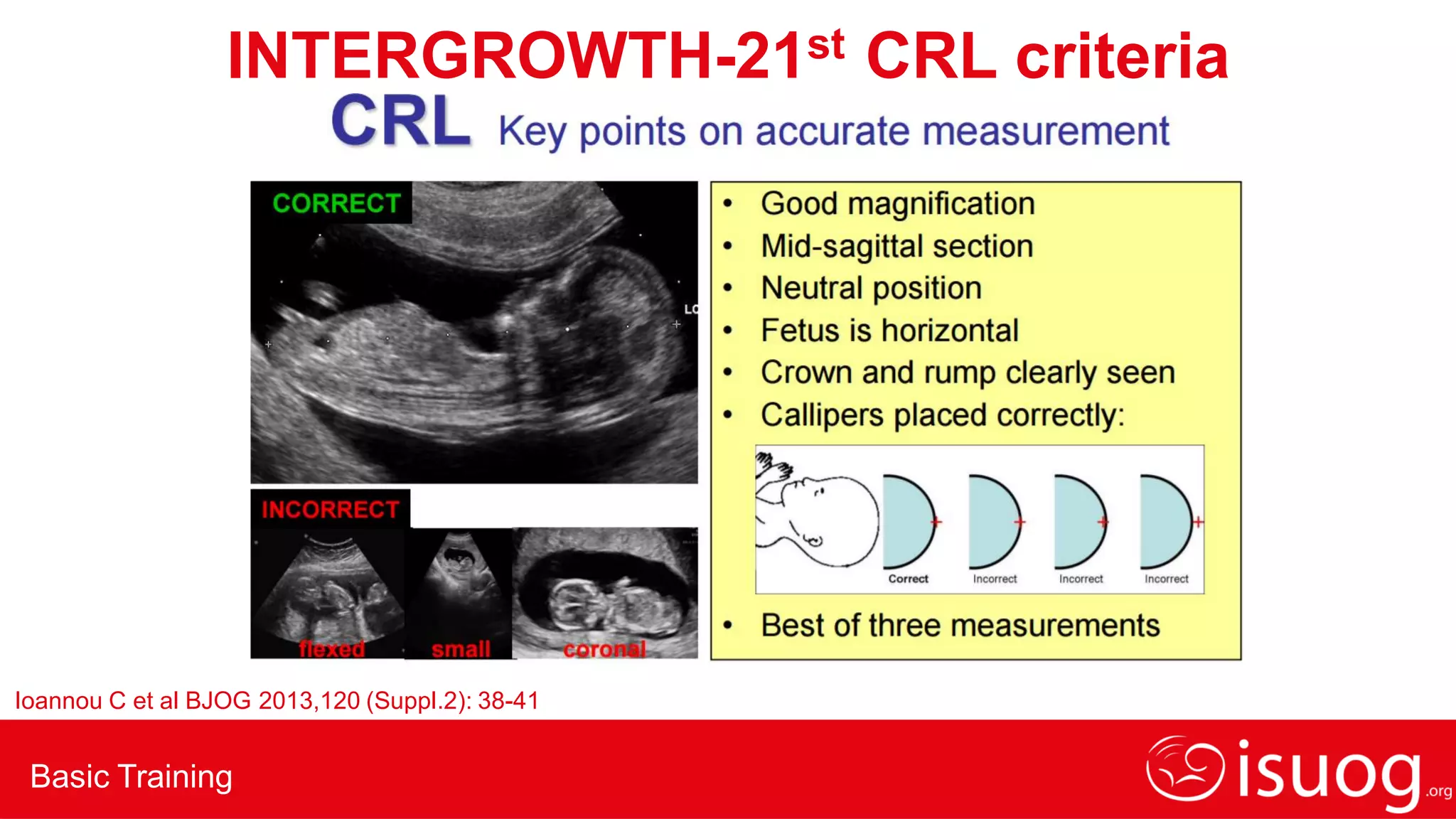 Lecture-10-Fetal-Biometry-Dating-Assessing-Size-Estimating-Fetal-Weight.pdf