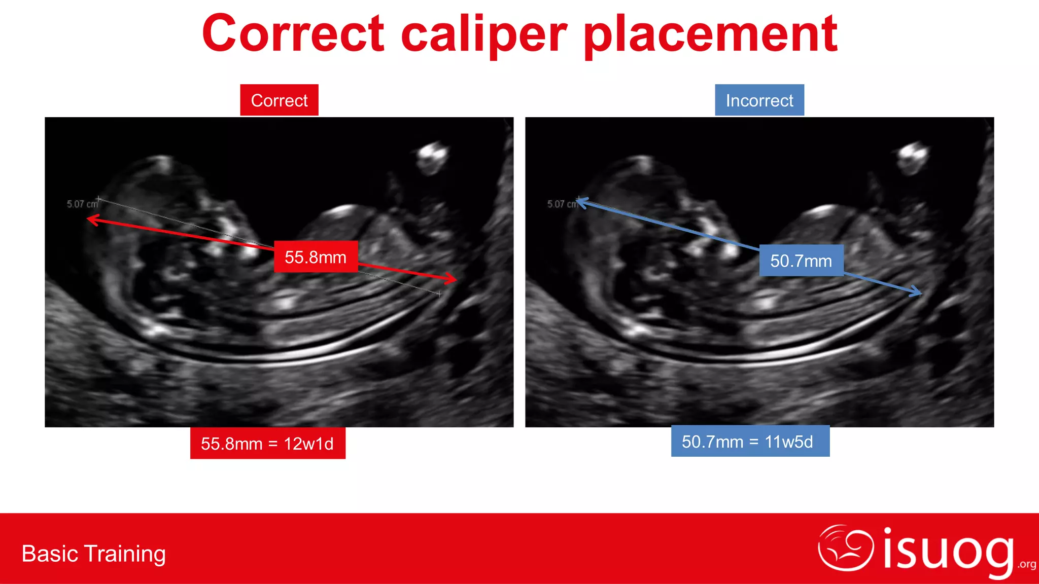 Lecture-10-Fetal-Biometry-Dating-Assessing-Size-Estimating-Fetal-Weight.pdf