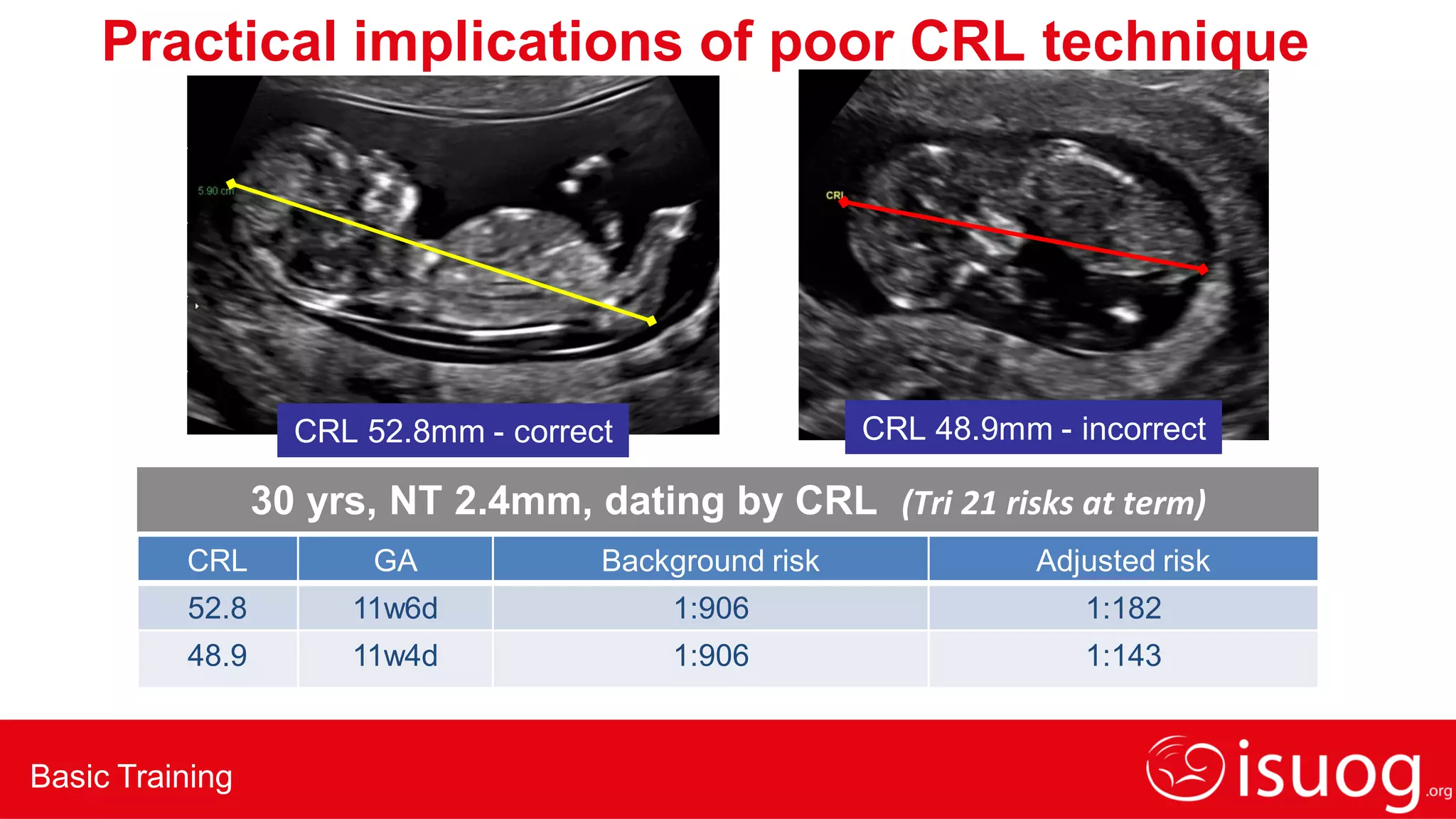 Lecture-10-Fetal-Biometry-Dating-Assessing-Size-Estimating-Fetal-Weight.pdf