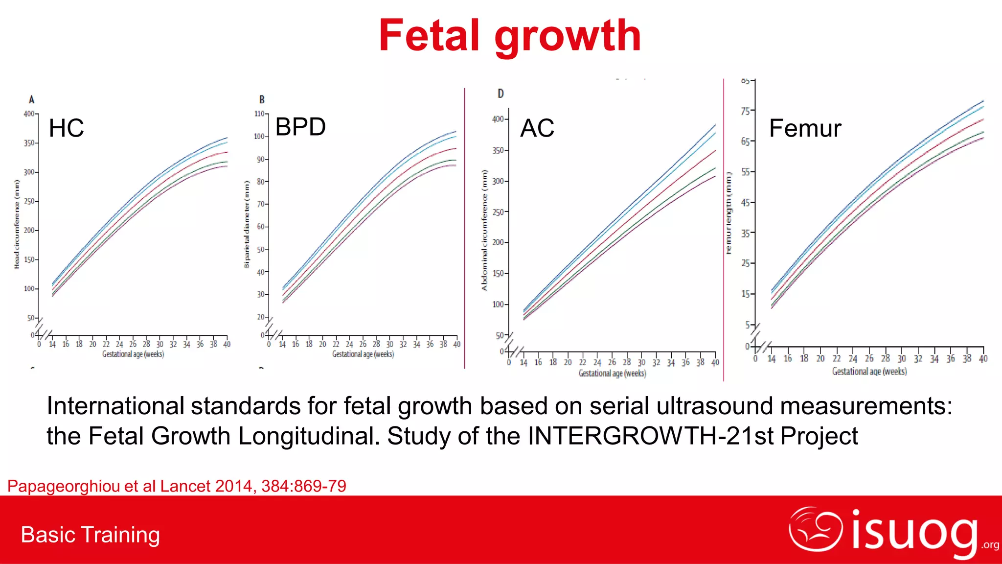 Lecture-10-Fetal-Biometry-Dating-Assessing-Size-Estimating-Fetal-Weig…