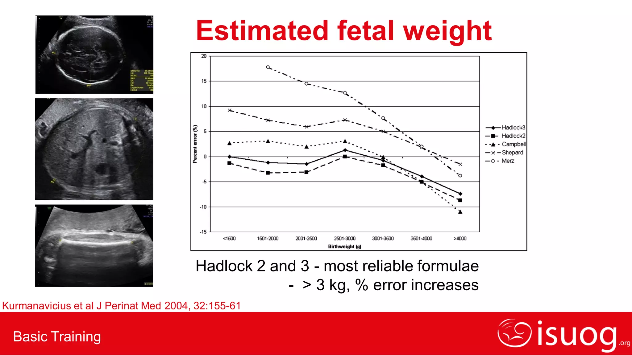 Lecture-10-Fetal-Biometry-Dating-Assessing-Size-Estimating-Fetal-Weig…