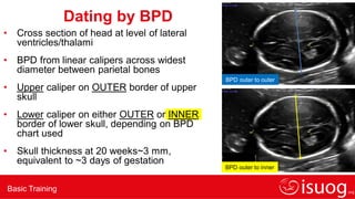 Lecture-10-Fetal-Biometry-Dating-Assessing-Size-Estimating-Fetal-Weight.pdf