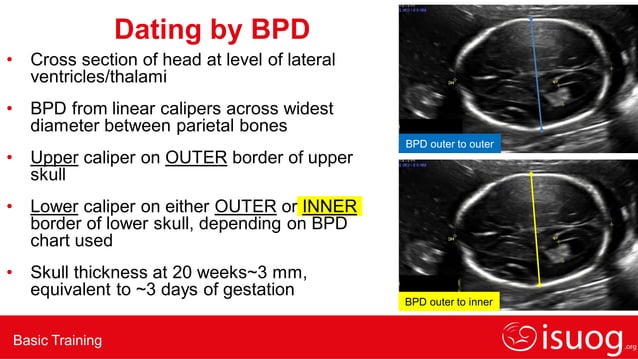 Lecture-10-Fetal-Biometry-Dating-Assessing-Size-Estimating-Fetal-Weight.pdf