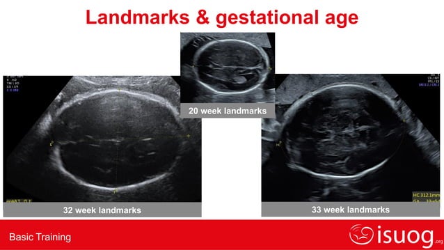 Lecture-10-Fetal-Biometry-Dating-Assessing-Size-Estimating-Fetal-Weight.pdf