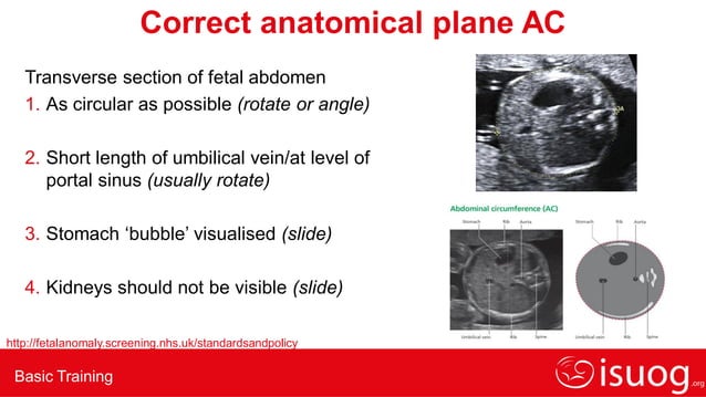 Lecture-10-Fetal-Biometry-Dating-Assessing-Size-Estimating-Fetal-Weight.pdf