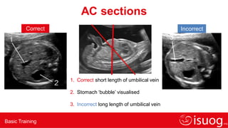 Lecture-10-Fetal-Biometry-Dating-Assessing-Size-Estimating-Fetal-Weight.pdf