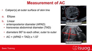 Lecture-10-Fetal-Biometry-Dating-Assessing-Size-Estimating-Fetal-Weight.pdf