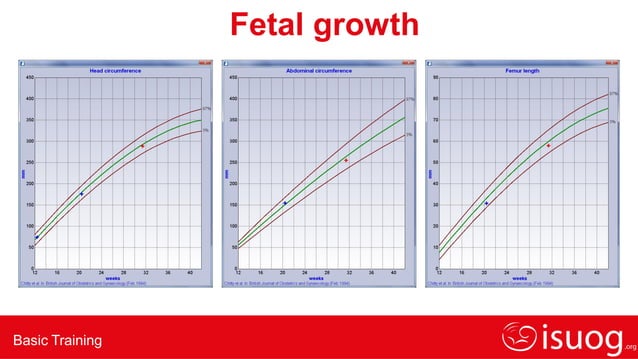 Lecture-10-Fetal-Biometry-Dating-Assessing-Size-Estimating-Fetal-Weight.pdf