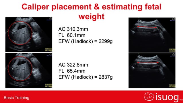 Lecture-10-Fetal-Biometry-Dating-Assessing-Size-Estimating-Fetal-Weight.pdf