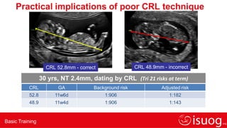 Lecture-10-Fetal-Biometry-Dating-Assessing-Size-Estimating-Fetal-Weight.pdf