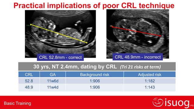 Lecture-10-Fetal-Biometry-Dating-Assessing-Size-Estimating-Fetal-Weight.pdf