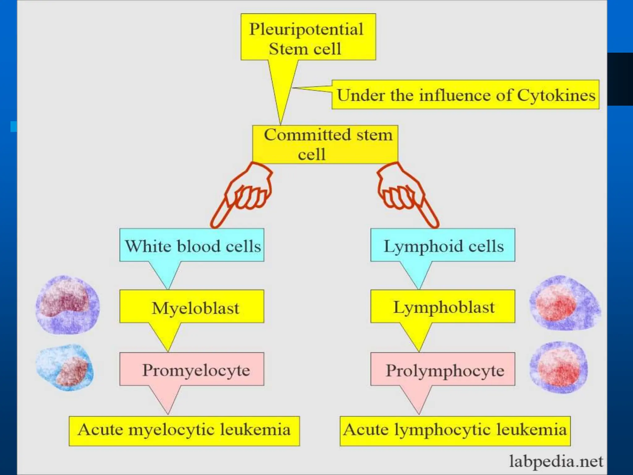 Lecture-11-Benign qualitative white blood cell disorders; benign ...