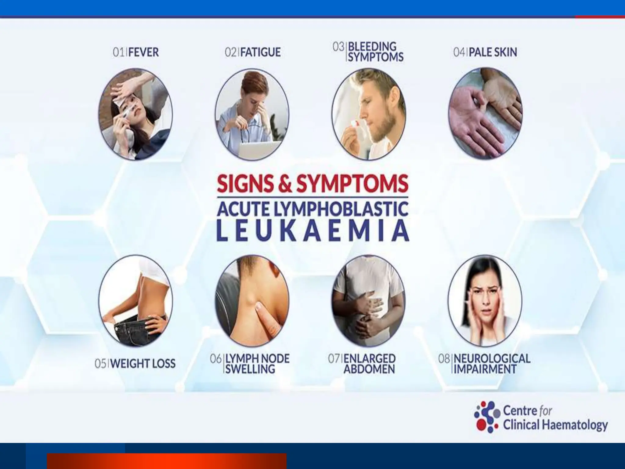 Lecture-11-Benign qualitative white blood cell disorders; benign qualitative WBC disorders ...