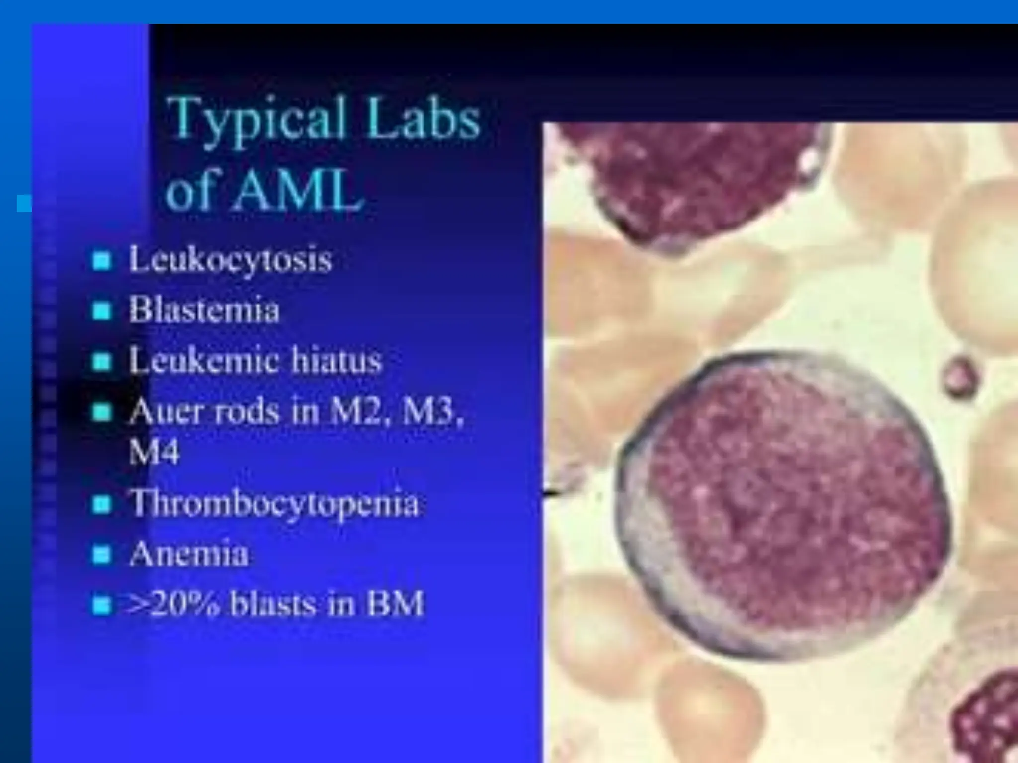 Lecture-11-Benign qualitative white blood cell disorders; benign ...