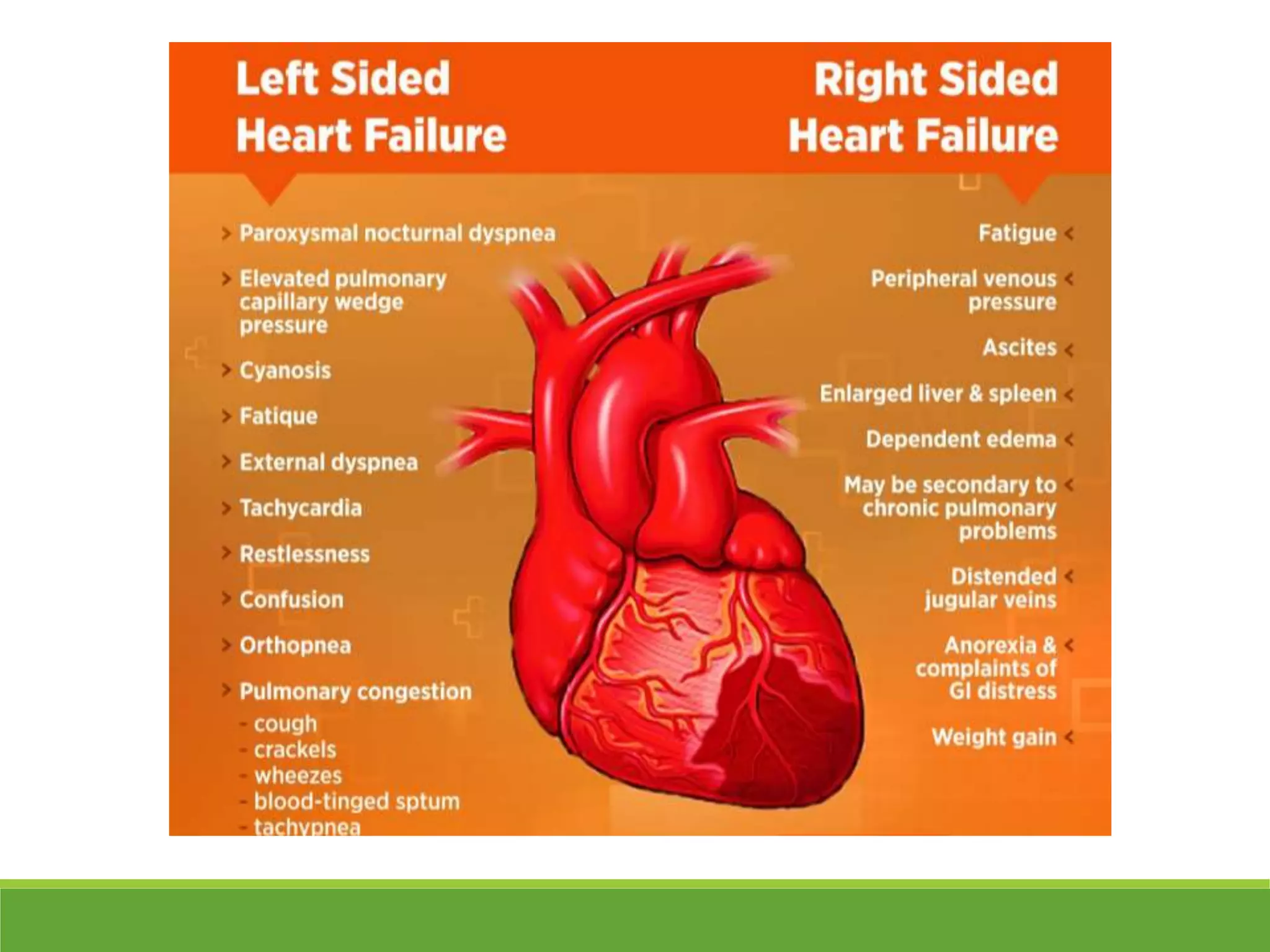 Lecture- 13. Congestive Cardiac Failure in Children | PPTX