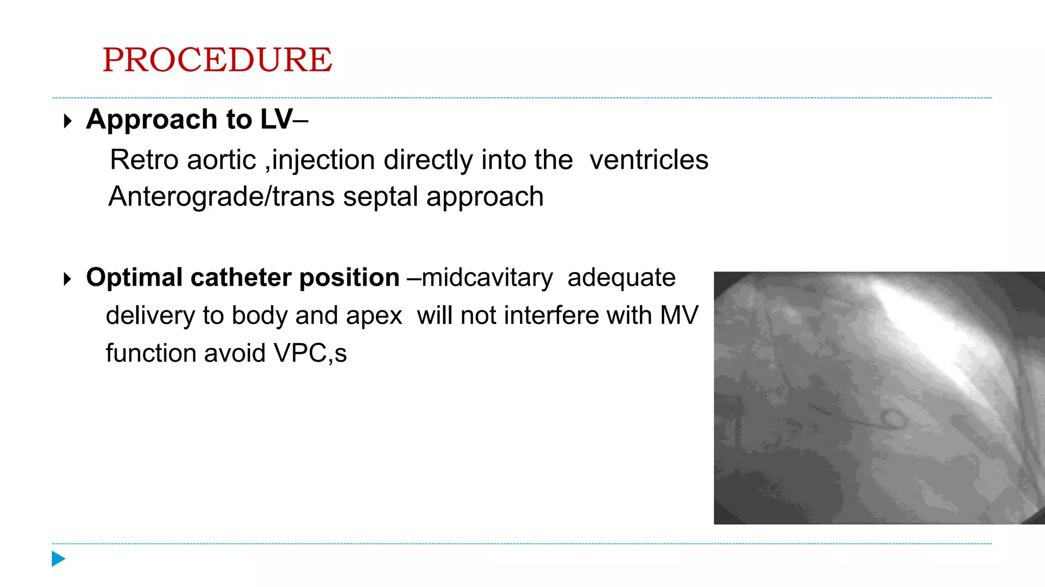 coronary angiography, LV angiogram and coronary anomalies | PPTX