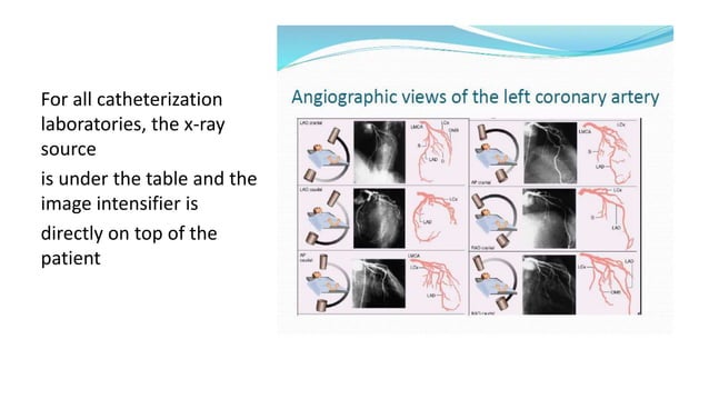 coronary angiography, LV angiogram and coronary anomalies | PPTX