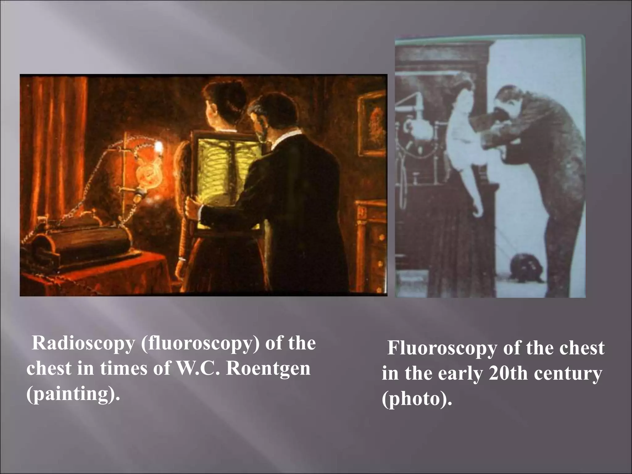 Lecture-1 Introduction to Roentgenology (9.12.16).ppt