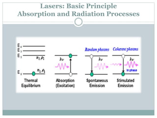 essential Lecture Lasers physics basics | PPT