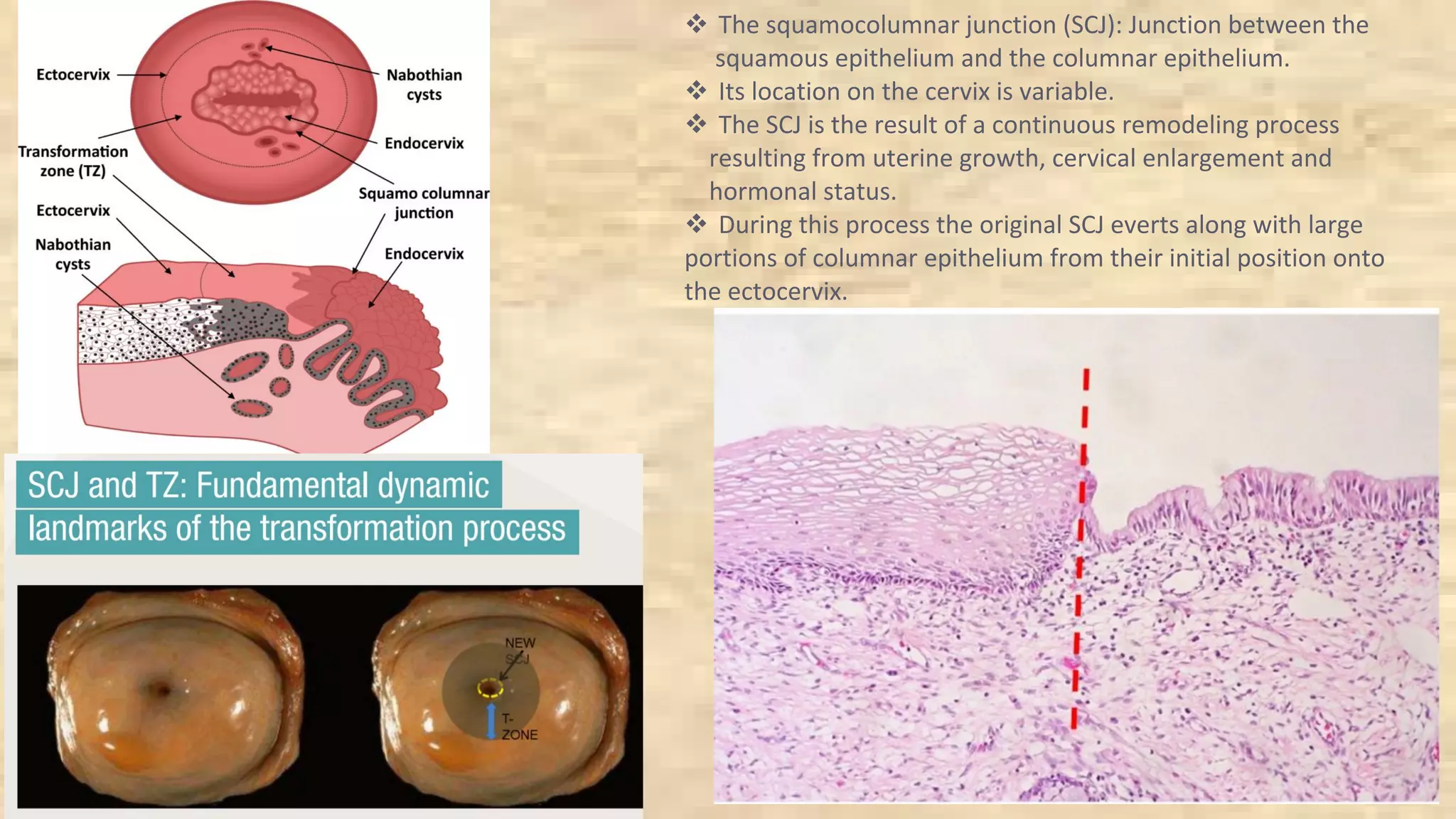 Lecture 1 Pathology: Cervix pdf | PDF