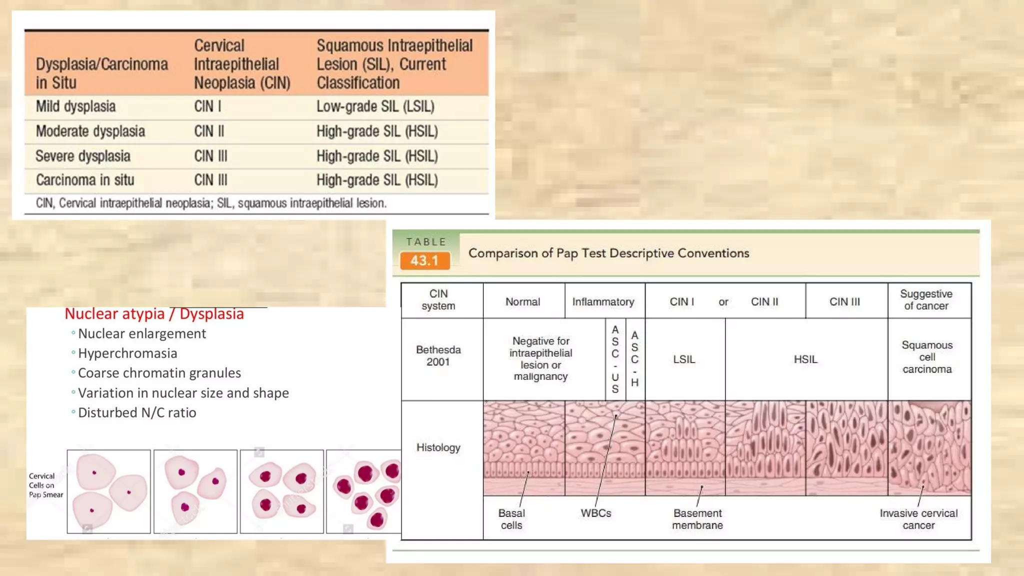 Lecture 1 Pathology: Cervix pdf | PDF