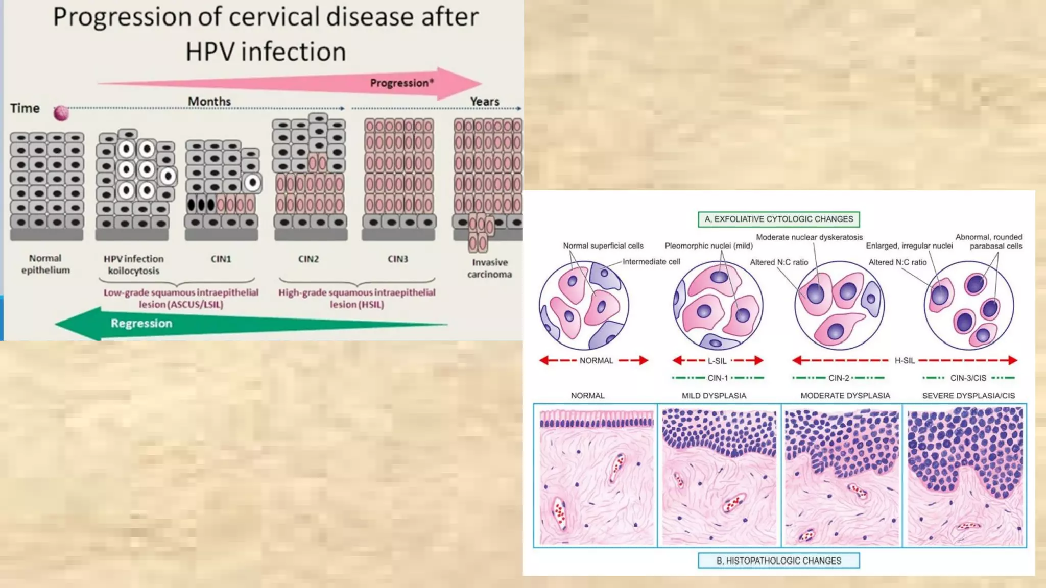 Lecture 1 Pathology: Cervix pdf | PDF