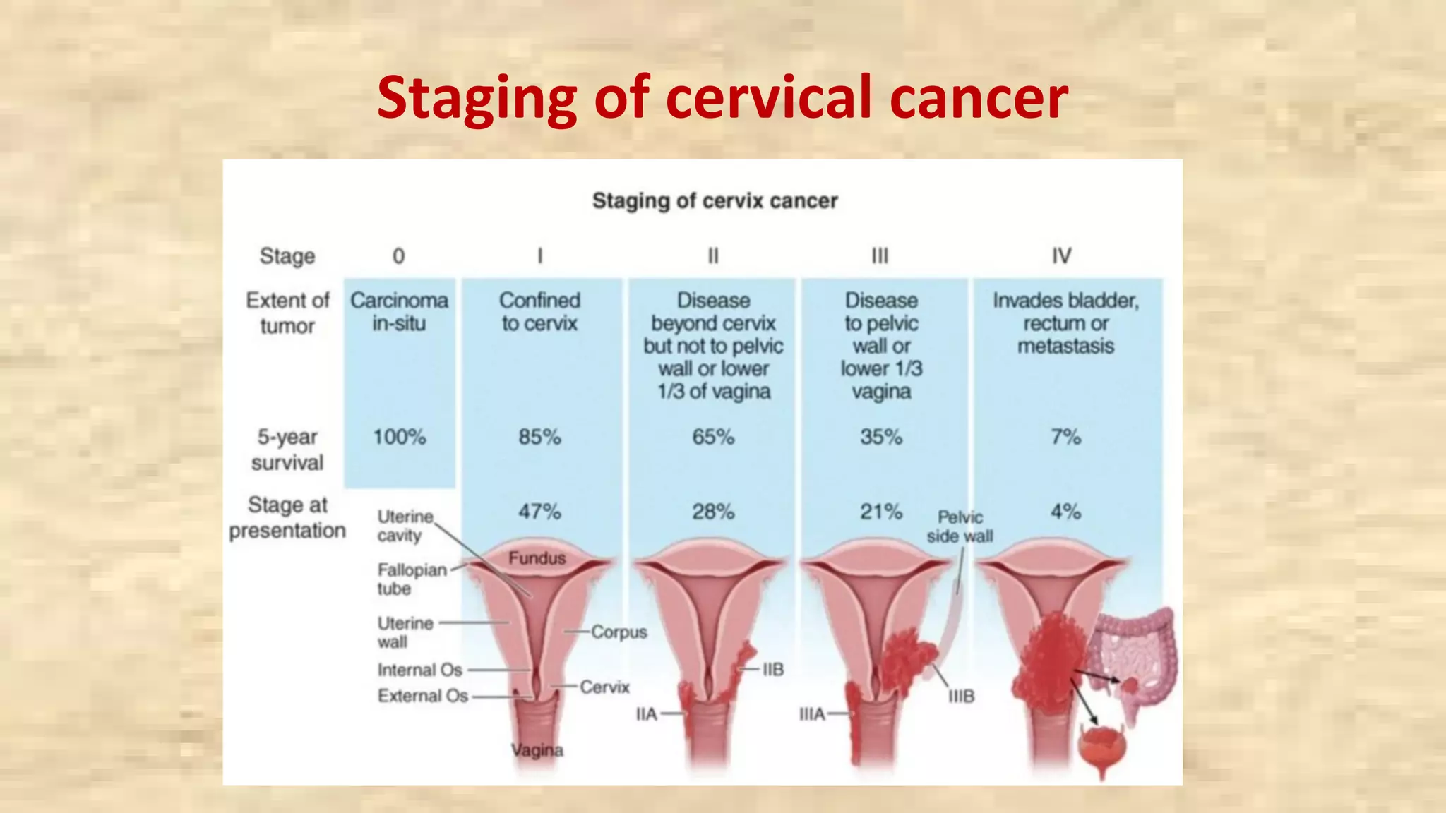 Lecture 1 Pathology: Cervix pdf | PDF