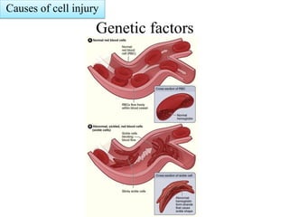 Lecture.1..Mechanisms.of.cell.injury.pdf