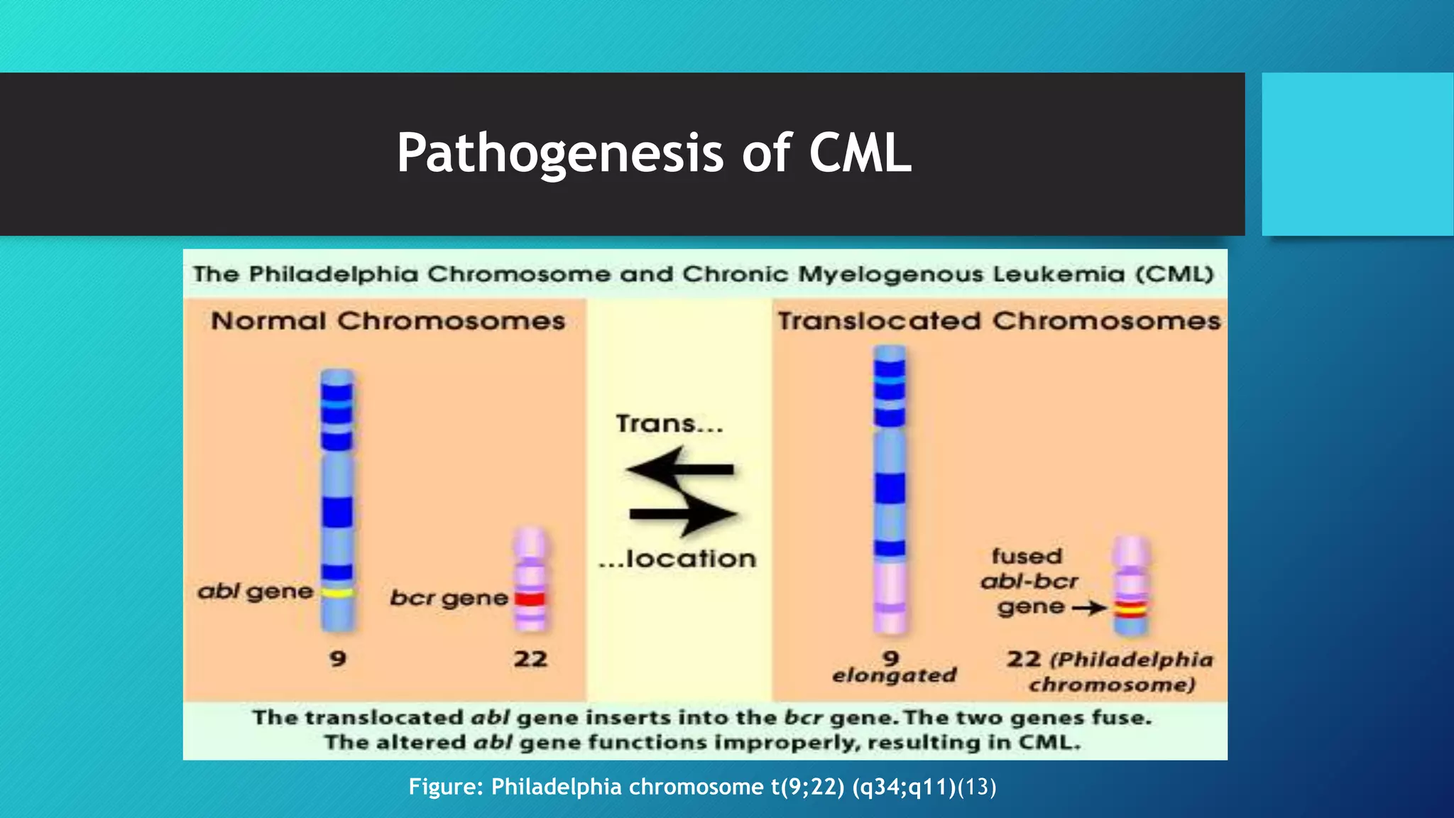 Chronic Myeloid Leukemia(CML) | PPTX