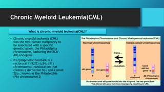 Chronic Myeloid Leukemia(CML) | PPTX