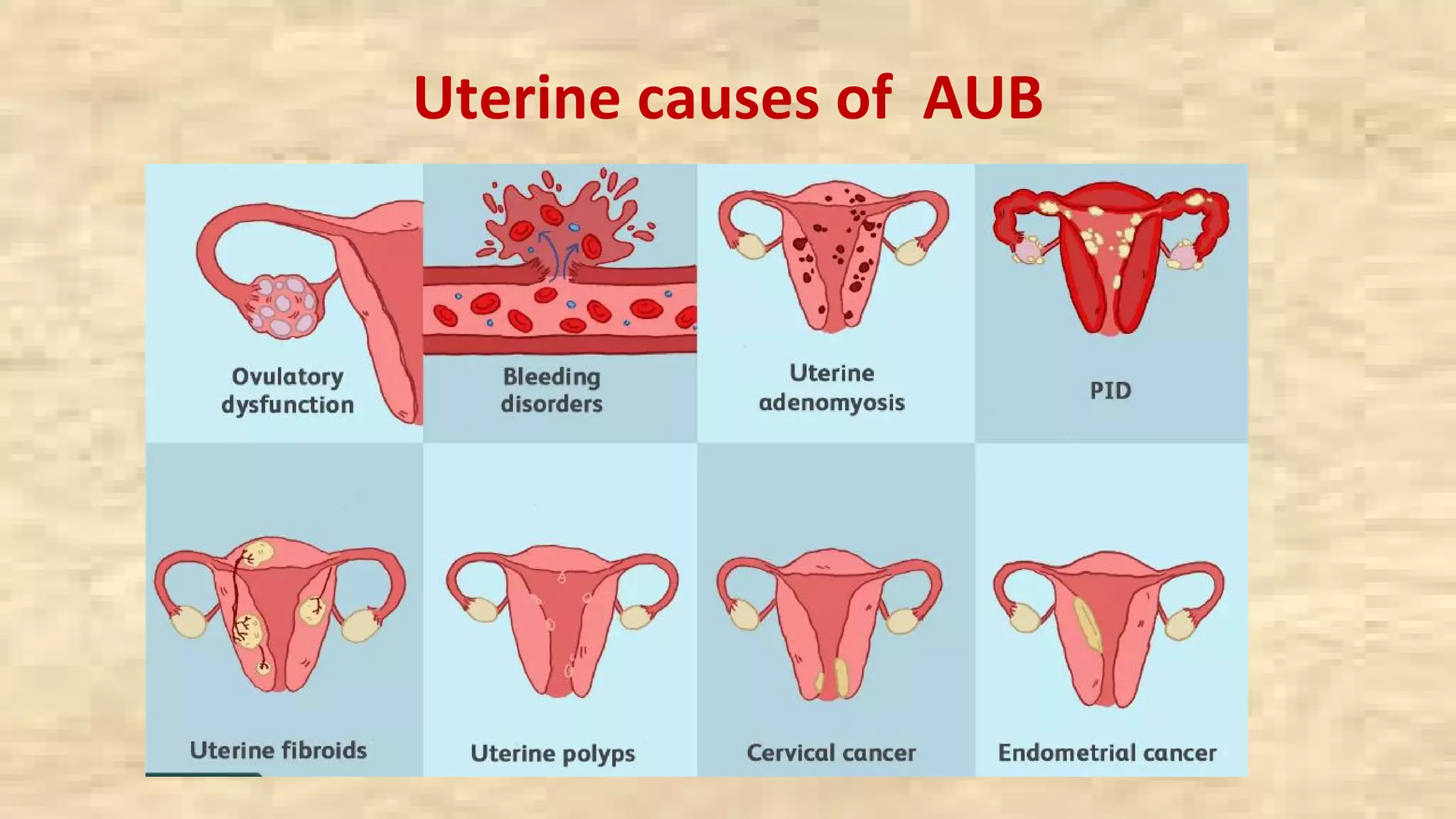 Lecture 2 Pathology: Uterus pdf | PPT