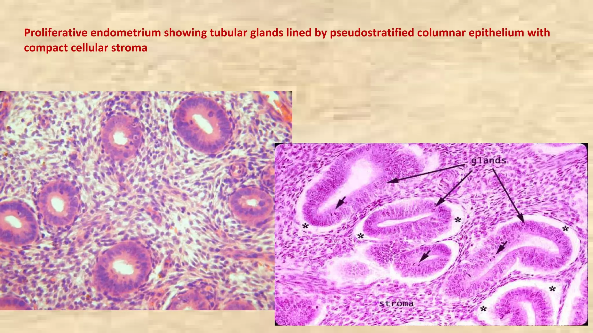 Lecture 2 Pathology Uterus Pdf Ppt