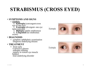 Principles of Clinical Medicine - Disorders of the eye | PPTX