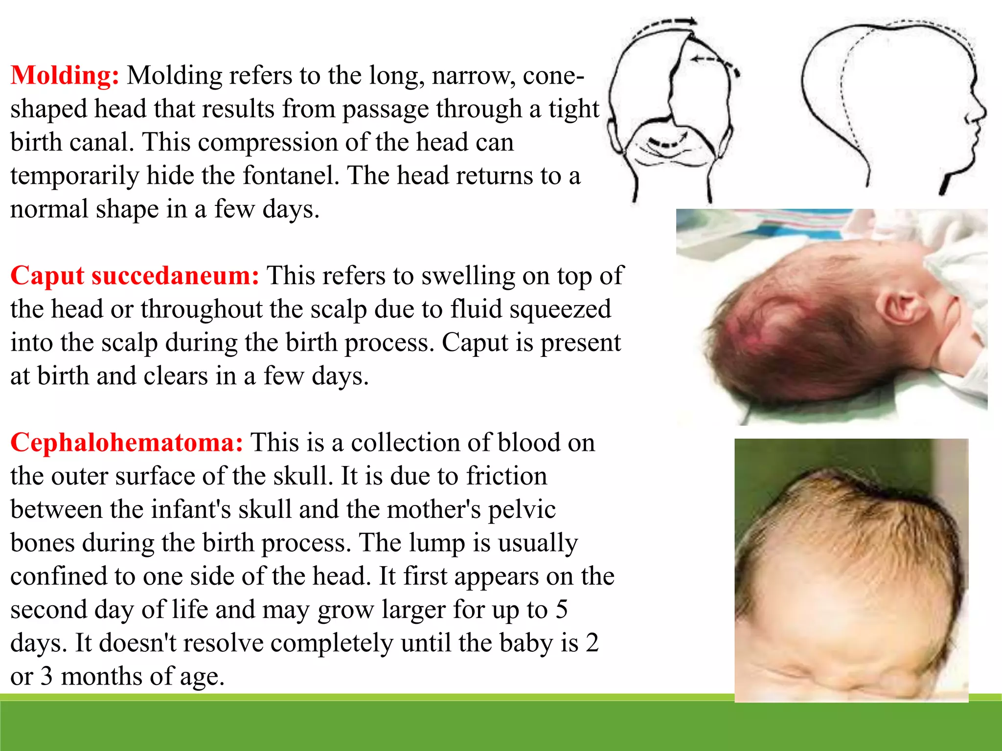 Lecture 4. Normal Newborn | PPTX | Pregnancy | Reproductive Health
