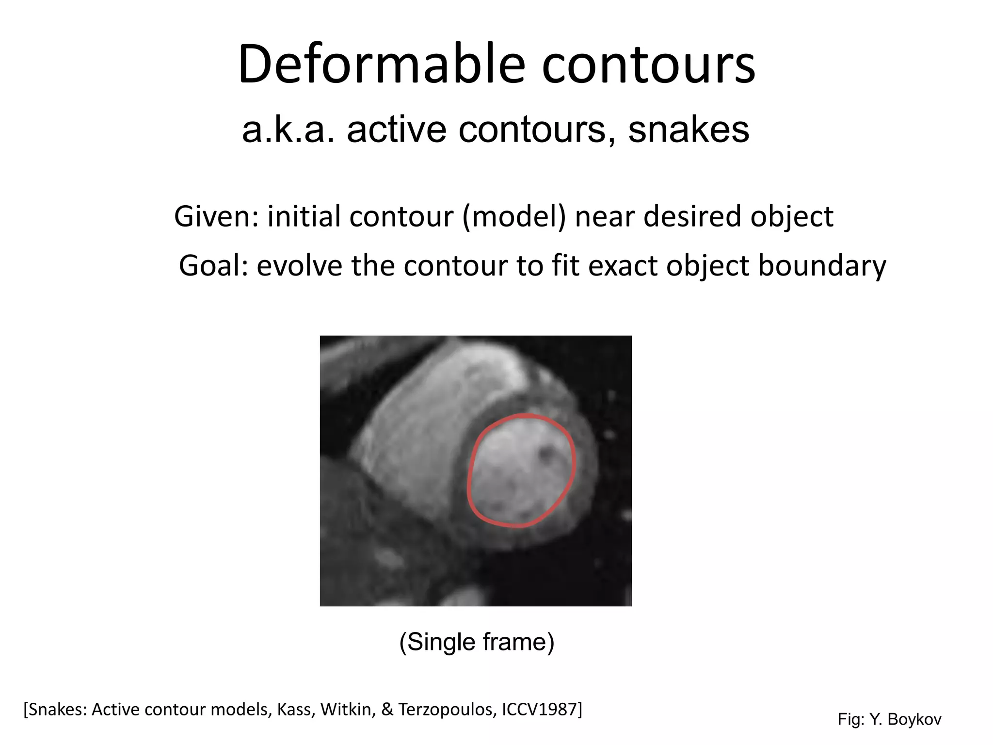 Lecture 4and5 Computer Vision Edge Detection Code Chains Hough Transform