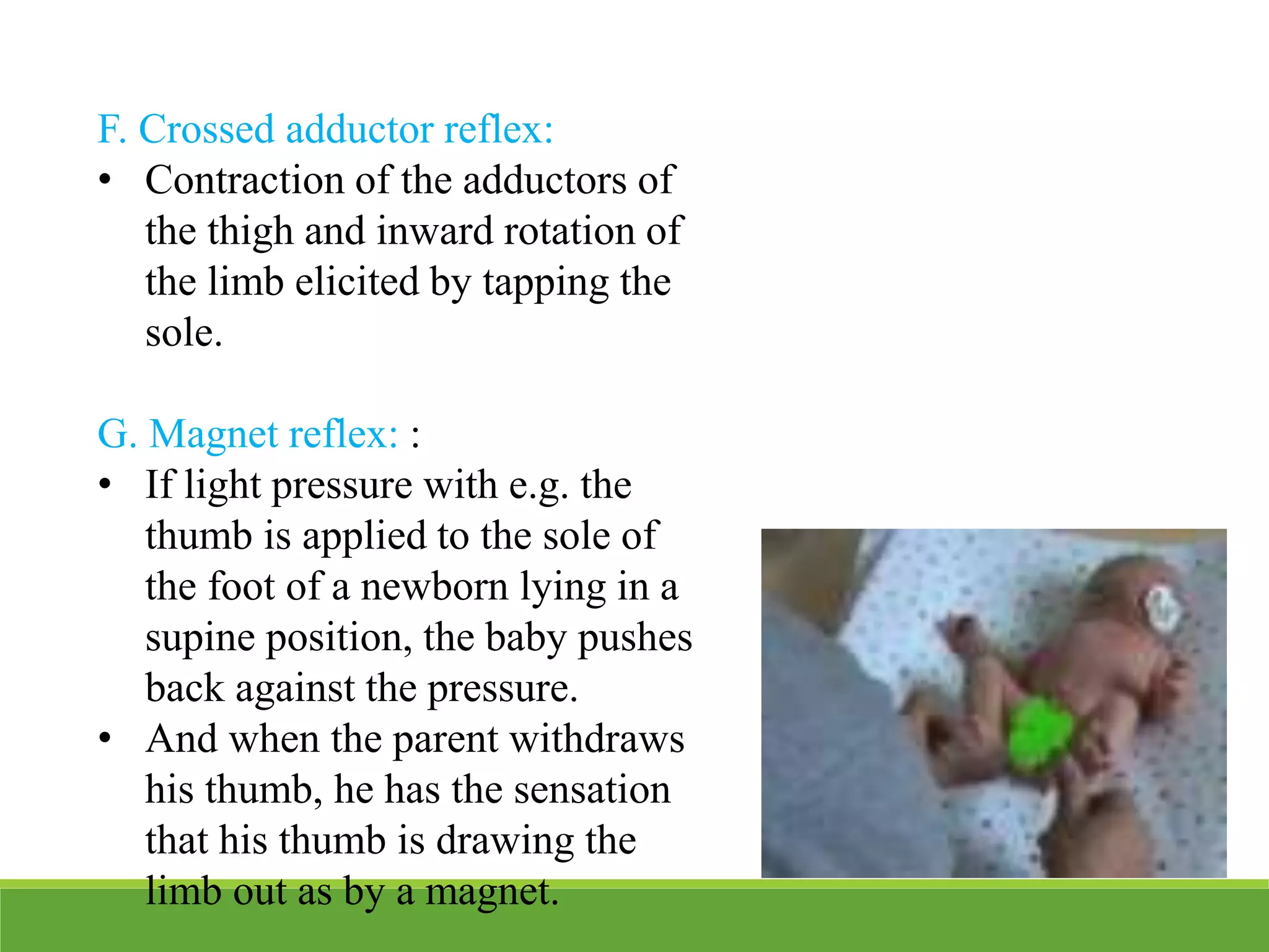 Lecture 5. Neonatal reflexes | PPTX