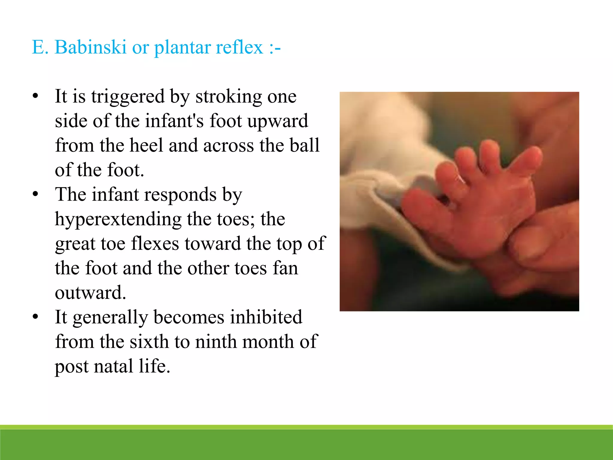 Lecture 5. Neonatal reflexes | PPTX